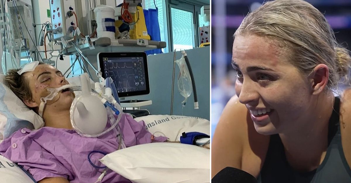 Simning: Fick hjärnskador efter cykelolyckan – nu är Alexa Leary ...