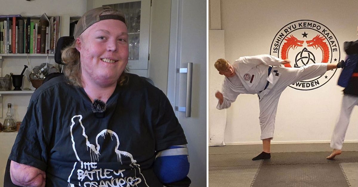 Viktor 18 Lost Arms And Legs To Sepsis Wants To Resume Karate And