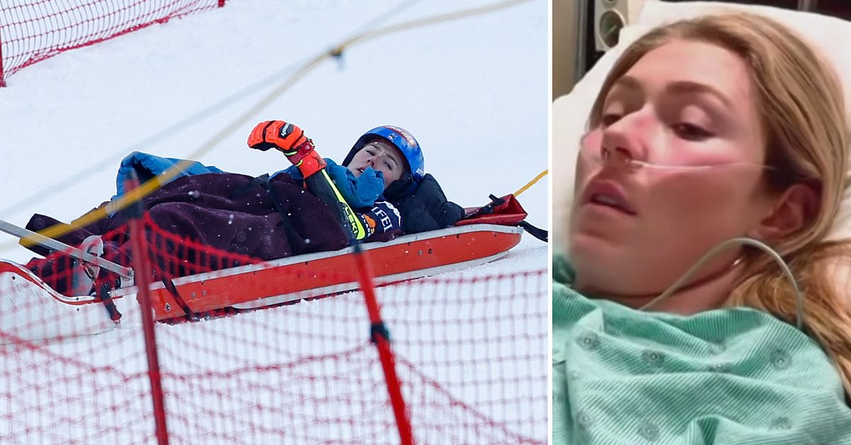 Alpint: Mikaela Shiffrin tvingad till oväntad operation: ”Känner mig deppig” | SVT Sport