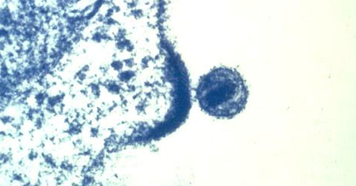 Det blir möjligt att bota HIV | SVT Nyheter