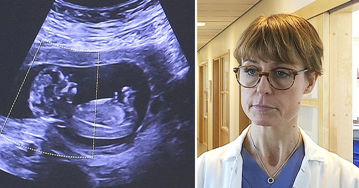 Åldersgräns för KUB-test tillbaka i sommar | SVT Nyheter