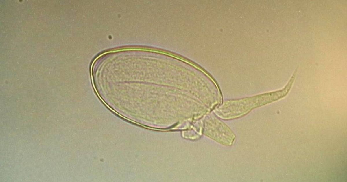 Medicin mot springmask slut i Stockholms län | SVT Nyheter