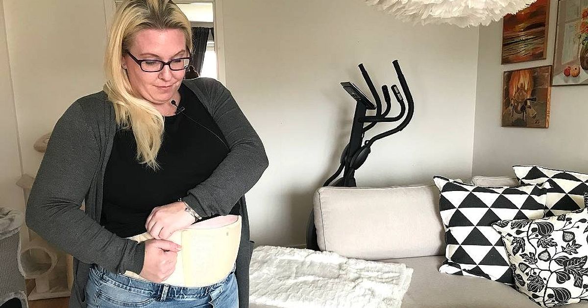 Caroline har levt med öppning i magen i tre år | SVT Nyheter