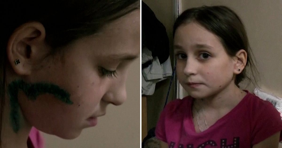 11-åriga Milena blev beskjuten: ”Jag hörde ett högt ljud i mina öron ...
