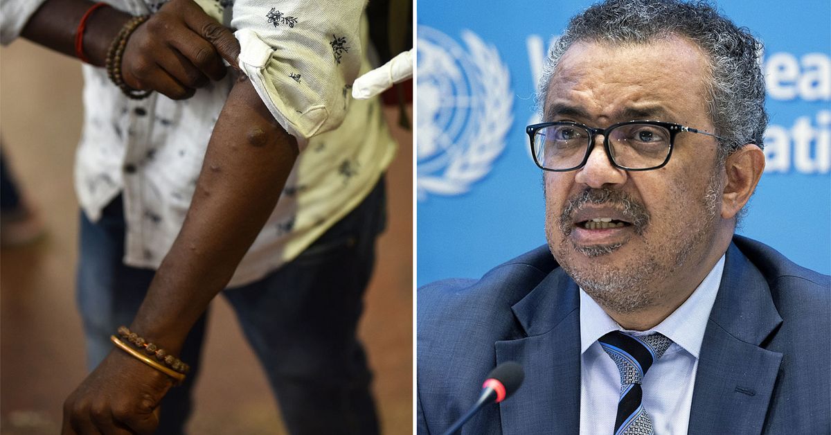 WHO: Apkoppor utgör ett internationellt hälsonödläge | SVT Nyheter