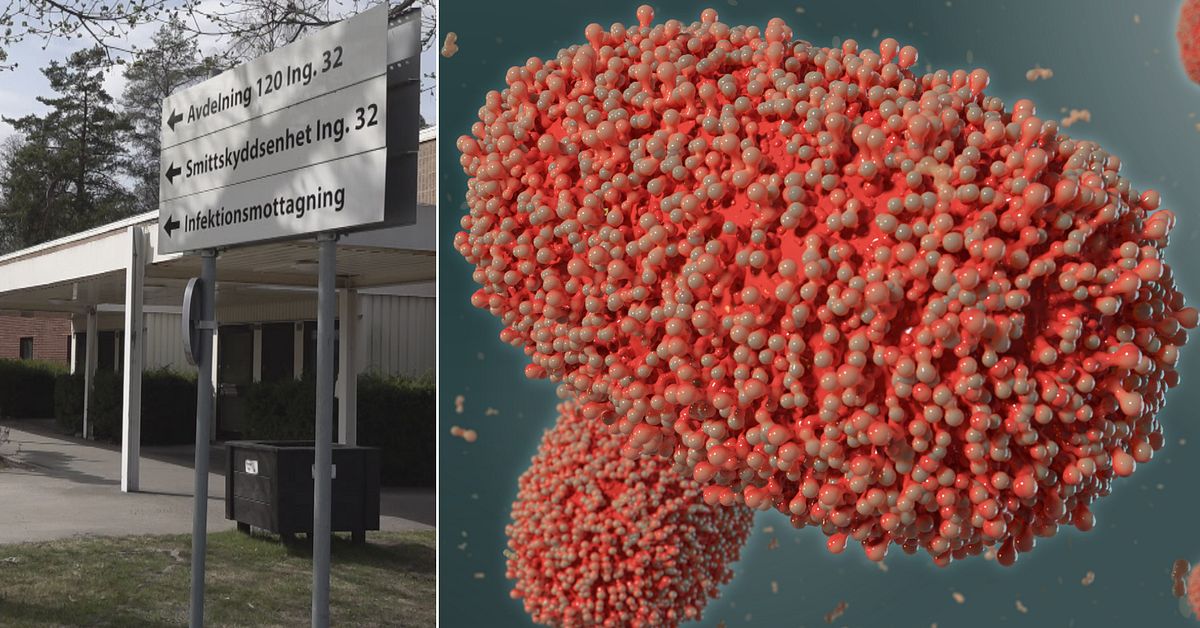 Första fallet av apkoppor bekräftat i Gävleborg | SVT Nyheter
