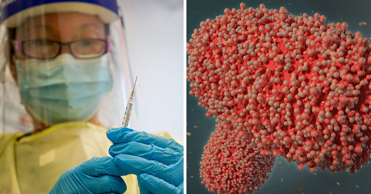 Sjukdomen apkoppor får nytt namn av WHO | SVT Nyheter