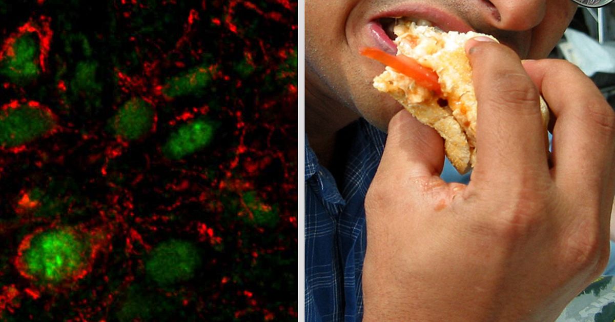 Magbakterier säger till när du är mätt | SVT Nyheter