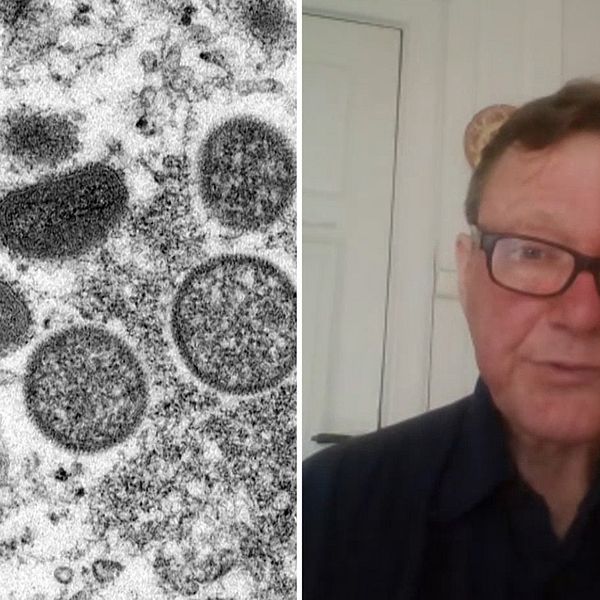 Spanien bekräftar: Ännu en person död i apkoppor | SVT Nyheter