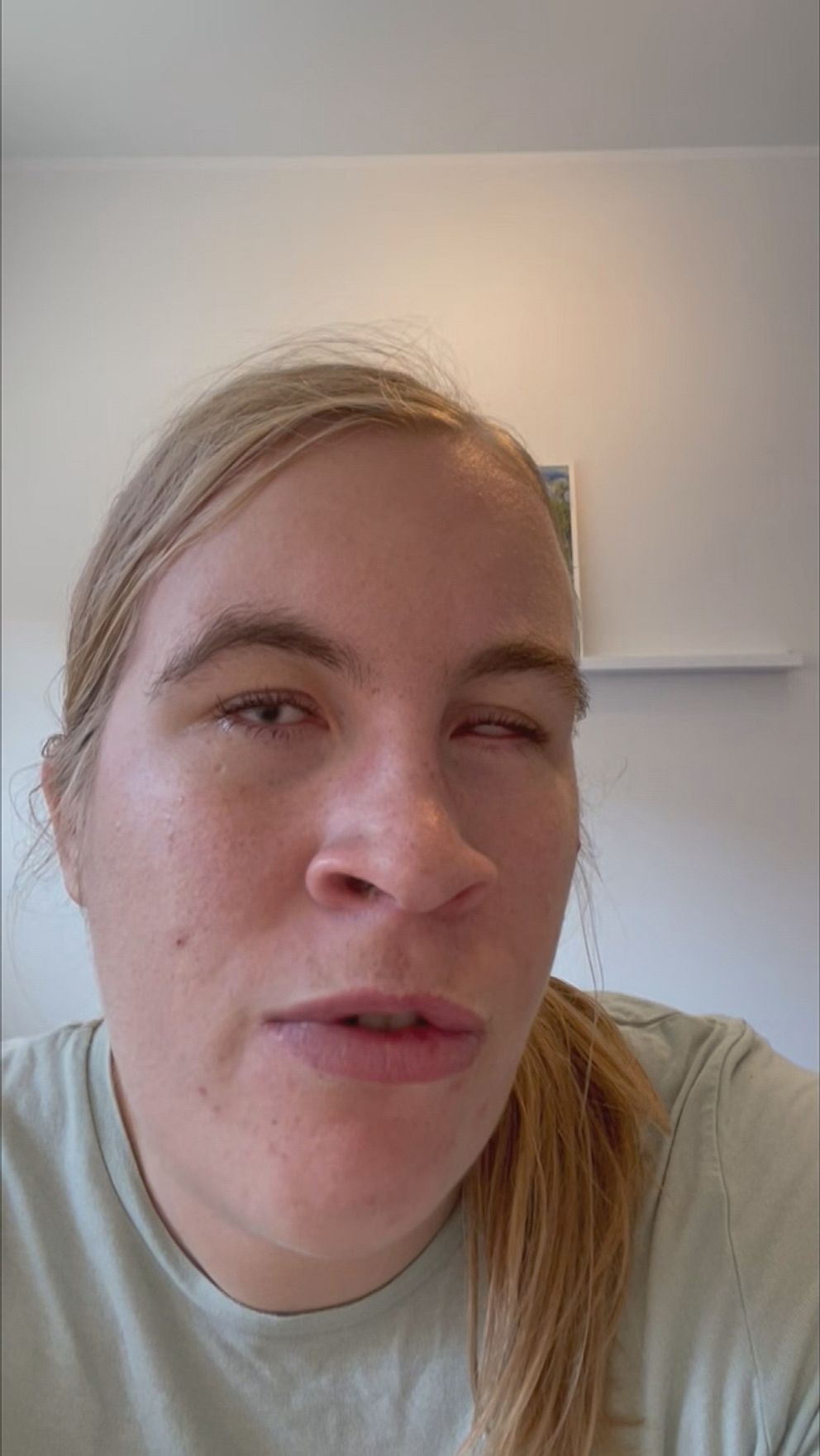 Synskadade vännerna kämpar för ett socialt liv: ”Vill vara som alla ...