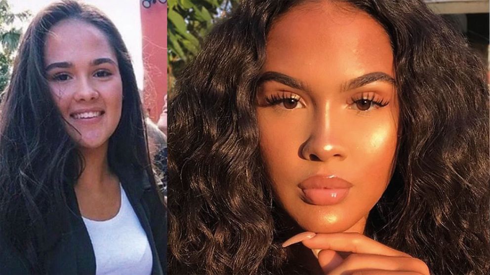 Svensk influencer anklagas för ”blackfishing” | SVT Nyheter