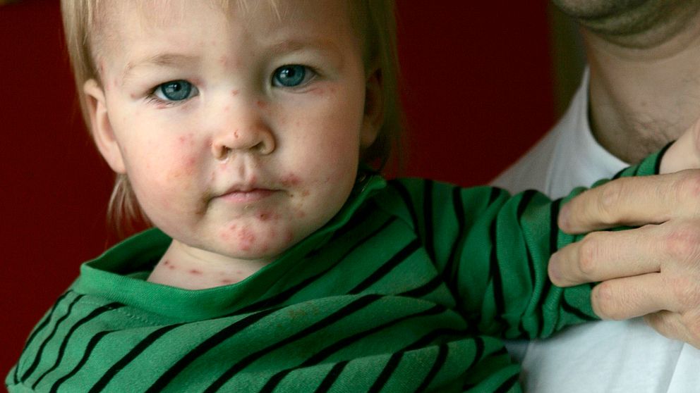 Allt fler barn vaccineras | SVT Nyheter