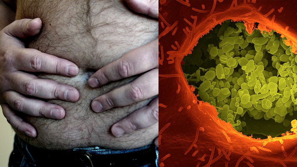 Tarmbakterier avgör vad du ska äta | SVT Nyheter