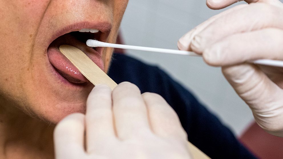 Läkare bedömde muncancer som kindbitning | SVT Nyheter