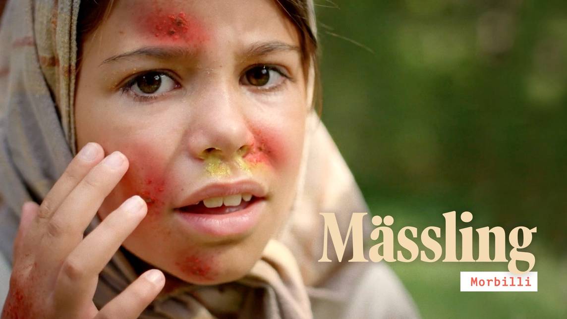 Världens hemskaste sjukdomar – 9. Mässling | SVT Play