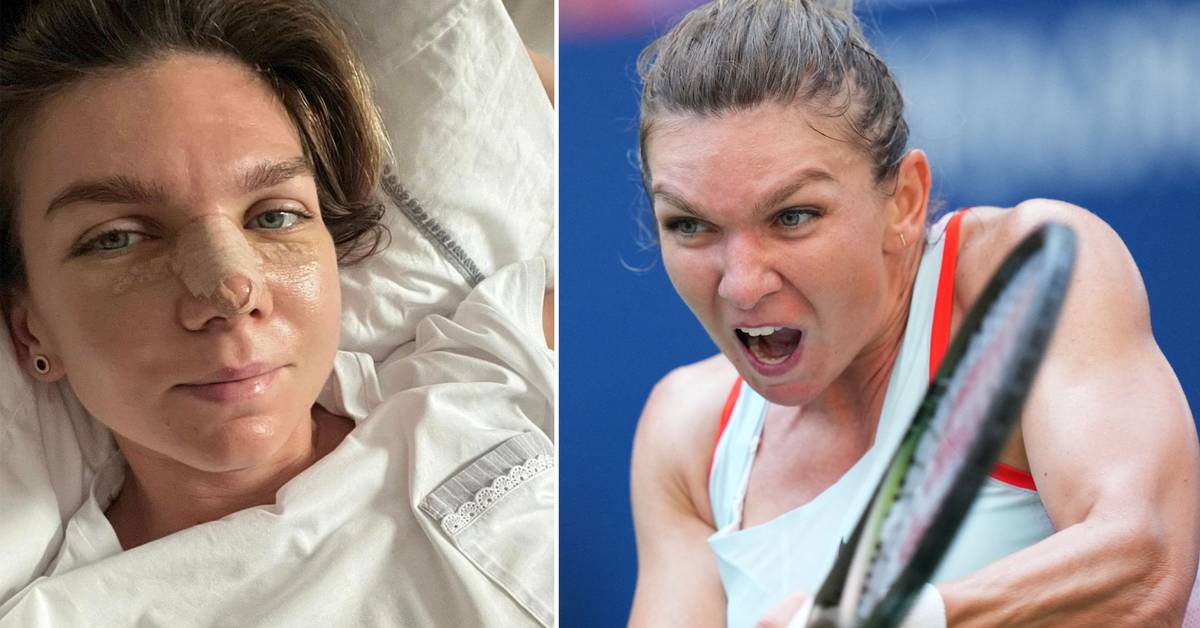 Simona Halep out for the rest of the year after nose surgery - Teller Report