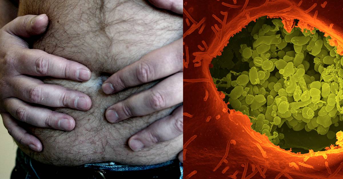 Tarmbakterier avgör vad du ska äta | SVT Nyheter