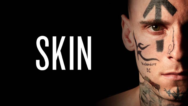 Skin | SVT Play