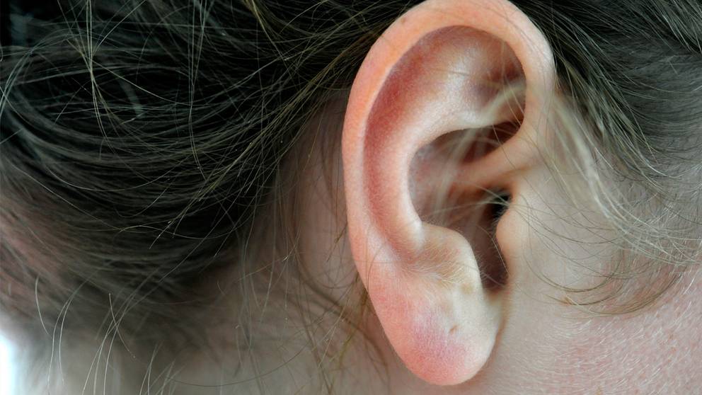 Blev döv efter öroninflammation | SVT Nyheter